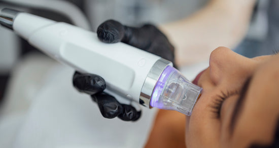 RADIO FREQUENCY/ MICRONEEDLING – Bay Aesthetics